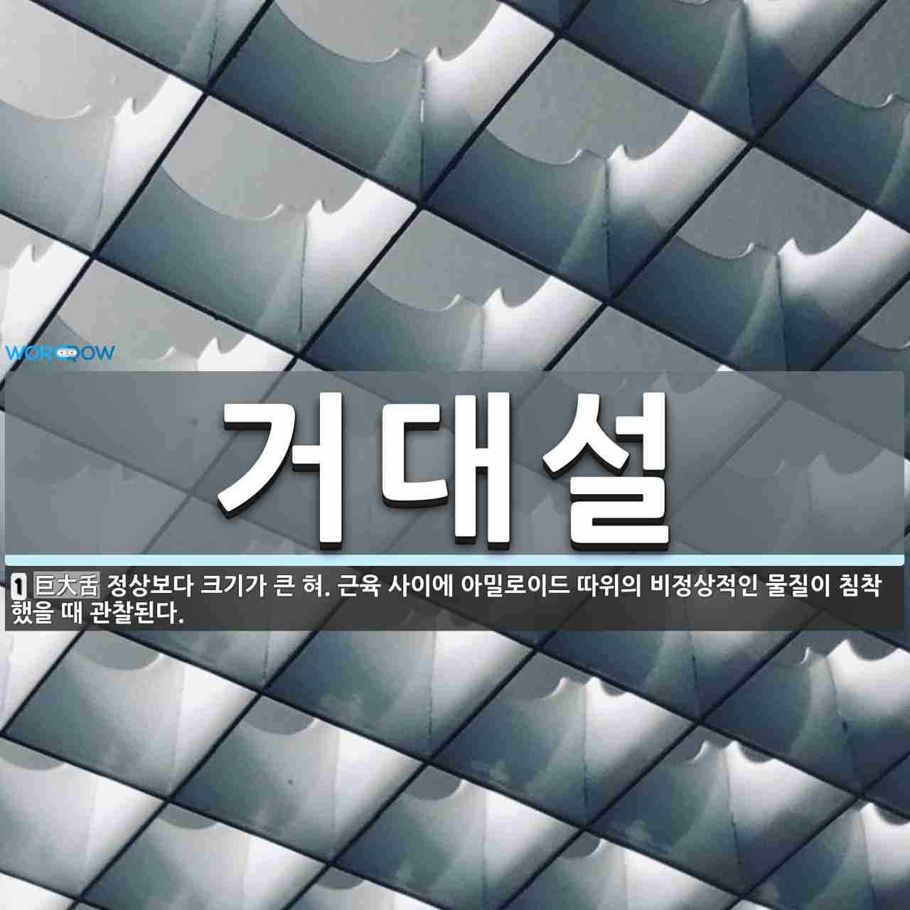 거대설 뜻: 정상보다 크기가 큰 혀. 근육 사이에 아밀로이드 따위의 비정상적인 물질이 침착했을 때 관찰